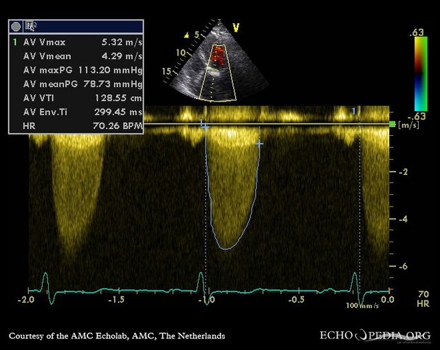 File:E00127.jpg - Echopedia
