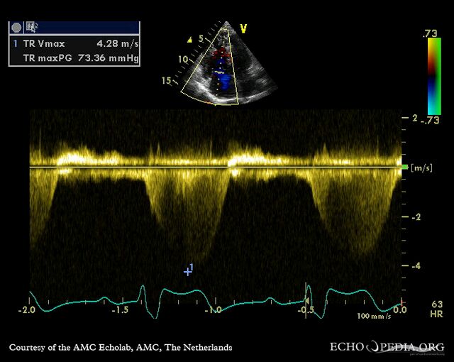 File:E00695.jpg - Echopedia