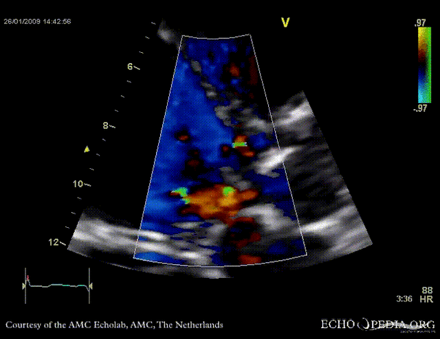 File:E00115.gif - Echopedia