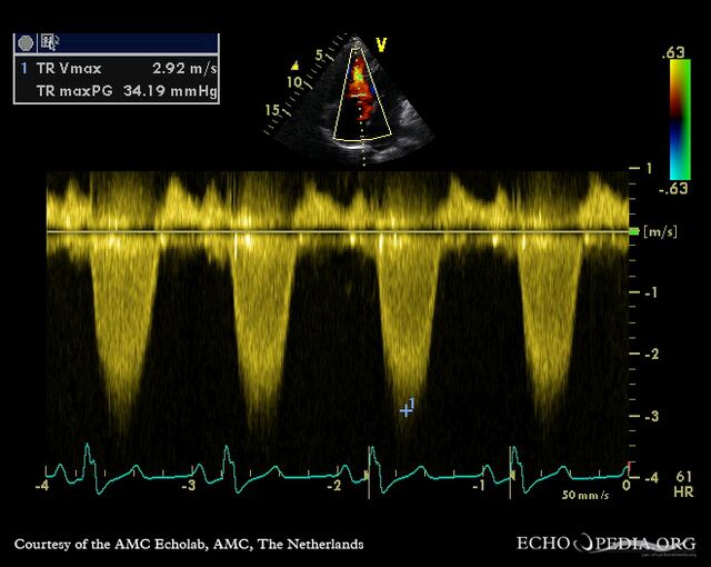 File:E00851.jpg - Echopedia