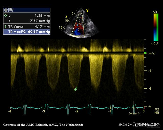 File:E00704.jpg - Echopedia