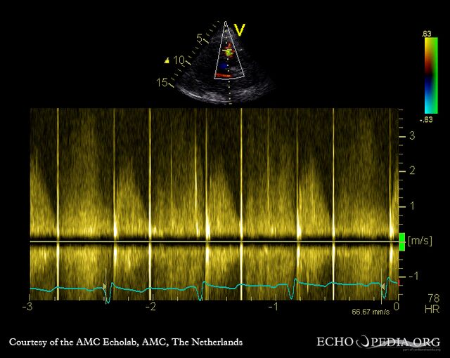 File:E00460.jpg - Echopedia