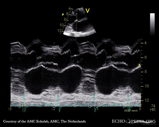 File:E00181.jpg - Echopedia