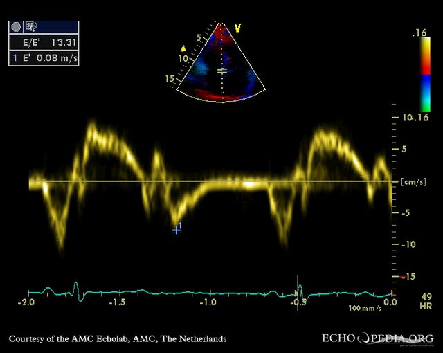 File:E00879.jpg - Echopedia