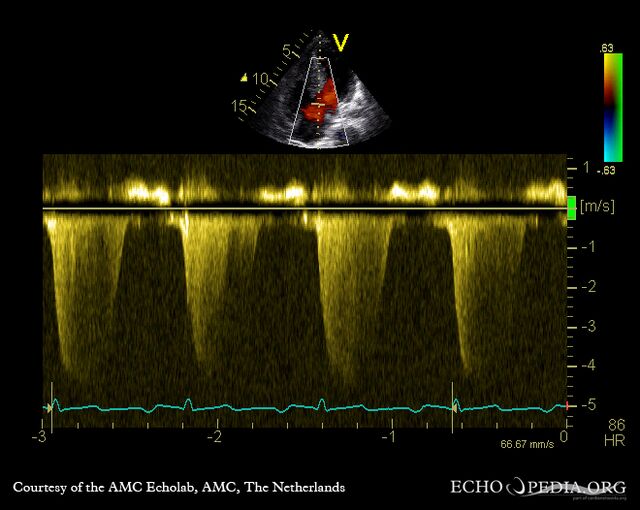File:E00324.jpg - Echopedia