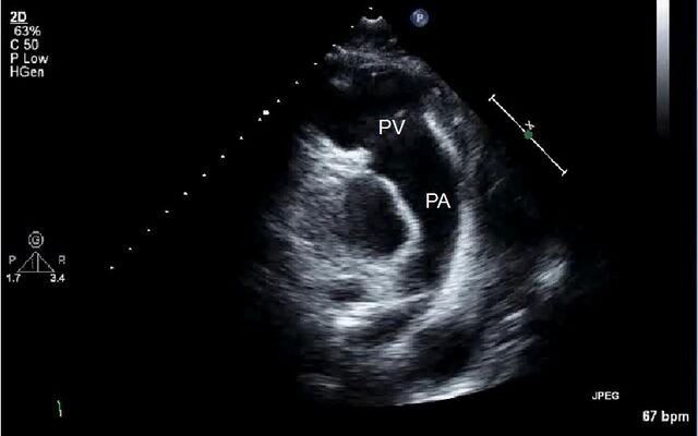 File:BasicsOfImagingFig7b.jpg - Echopedia