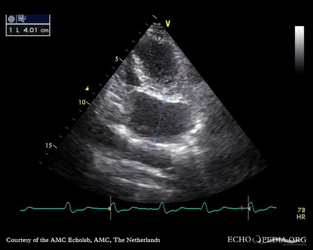 File:E00714.jpg - Echopedia