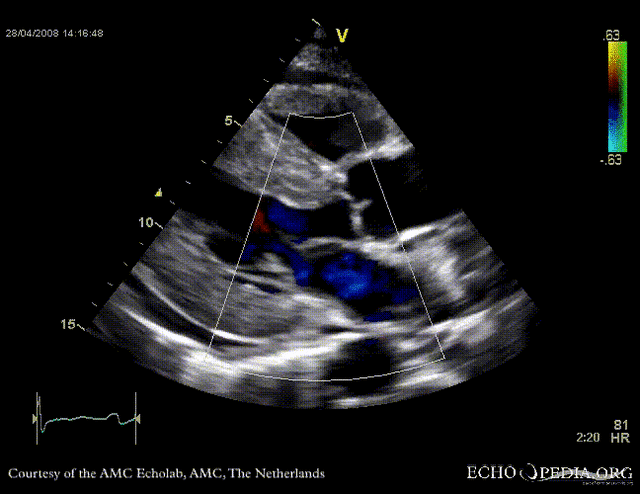 File:E00101.gif - Echopedia