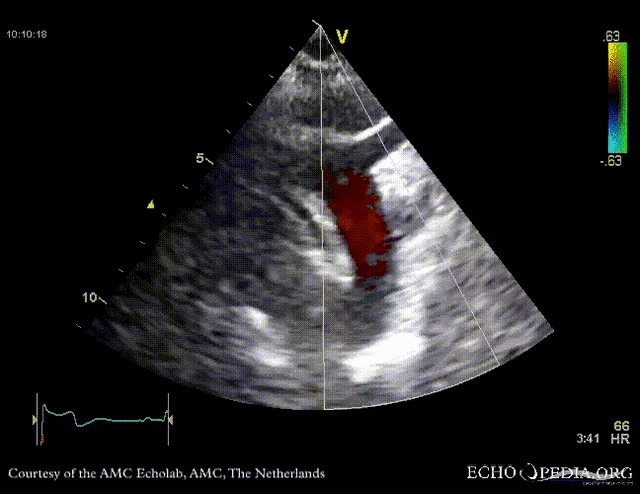 File:E00148.gif - Echopedia