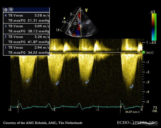 File:E00712.jpg - Echopedia