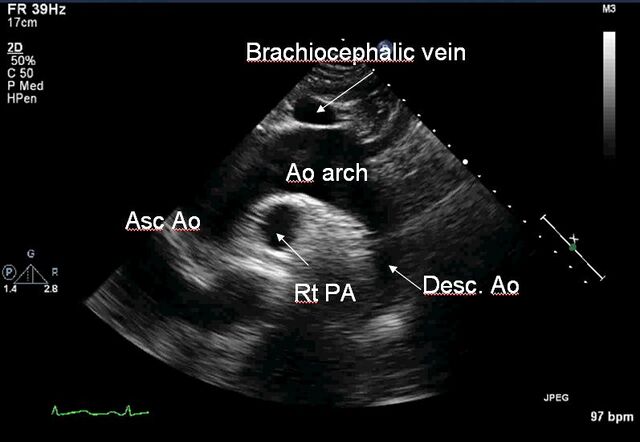 File:BasicsOfImagingFig21b.jpg - Echopedia