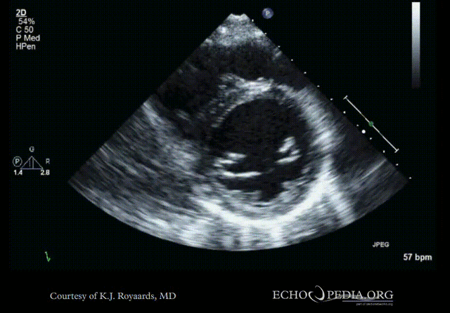 File:E00934.gif - Echopedia