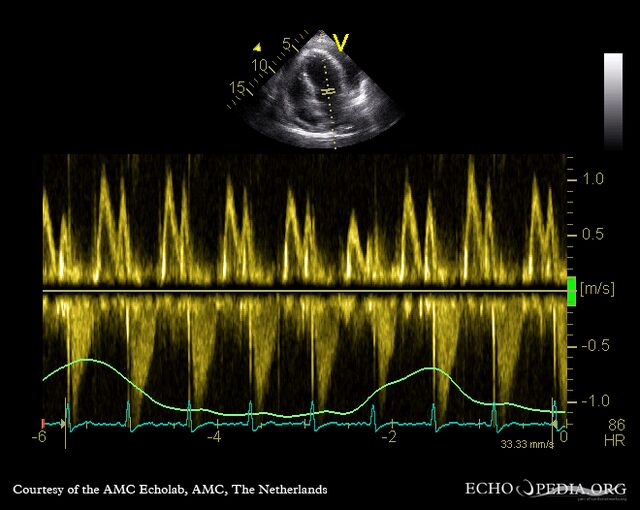 File:E00676.jpg - Echopedia