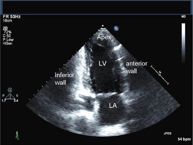 File:BasicsOfImagingFig16b.jpg - Echopedia