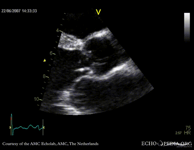 File:E00917.gif - Echopedia