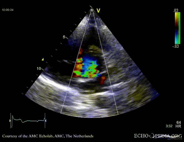File:E00144.gif - Echopedia