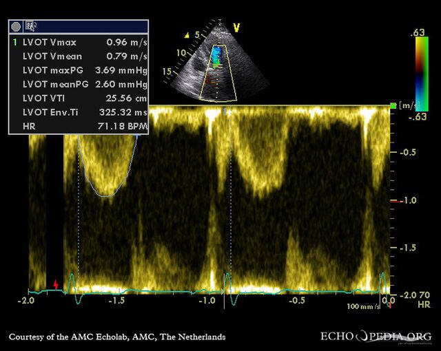 File:E00128.jpg - Echopedia