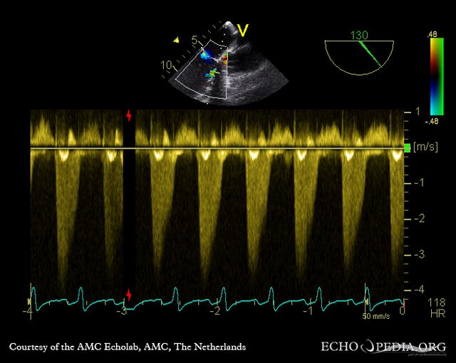 File:E00268.jpg - Echopedia