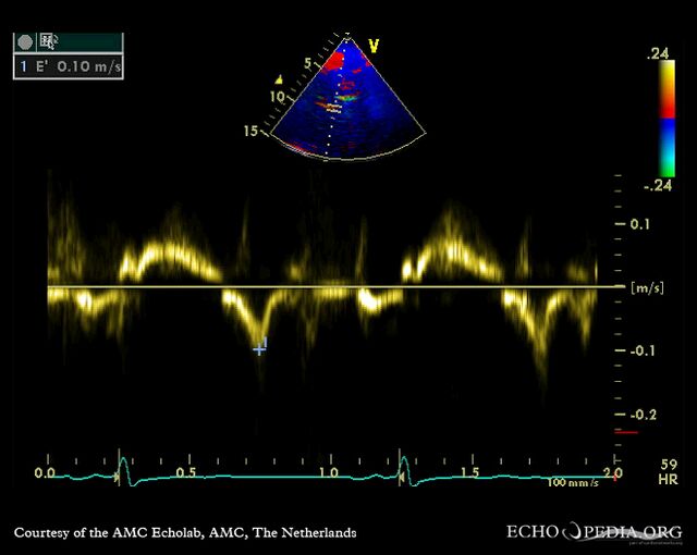File:E00700.jpg - Echopedia