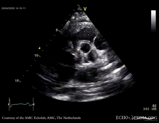 File:E00103.gif - Echopedia