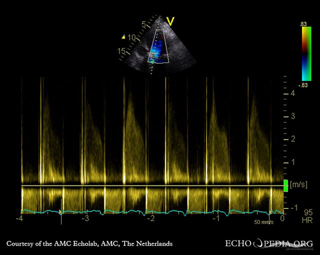 File:E00403.jpg - Echopedia