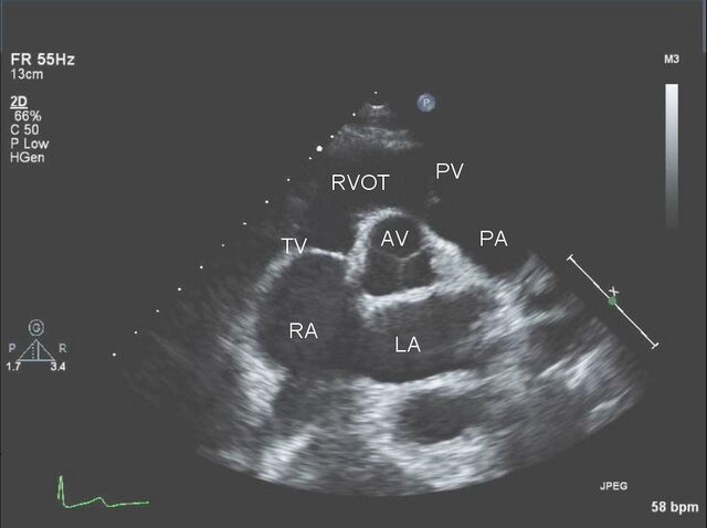 File:BasicsOfImagingFig9.jpg - Echopedia