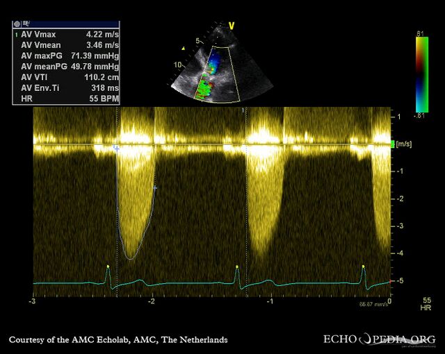 File:E00864.jpg - Echopedia